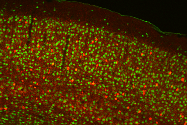 Why Naming Your Neurons Can Help Cure Brain Disease - The Data Science ...